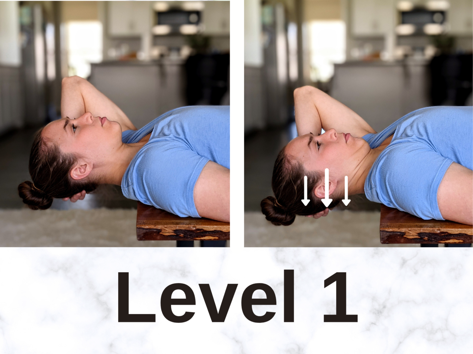 The Authoritative Guide to Cervical Radiculopathy (and 8 Effective ...