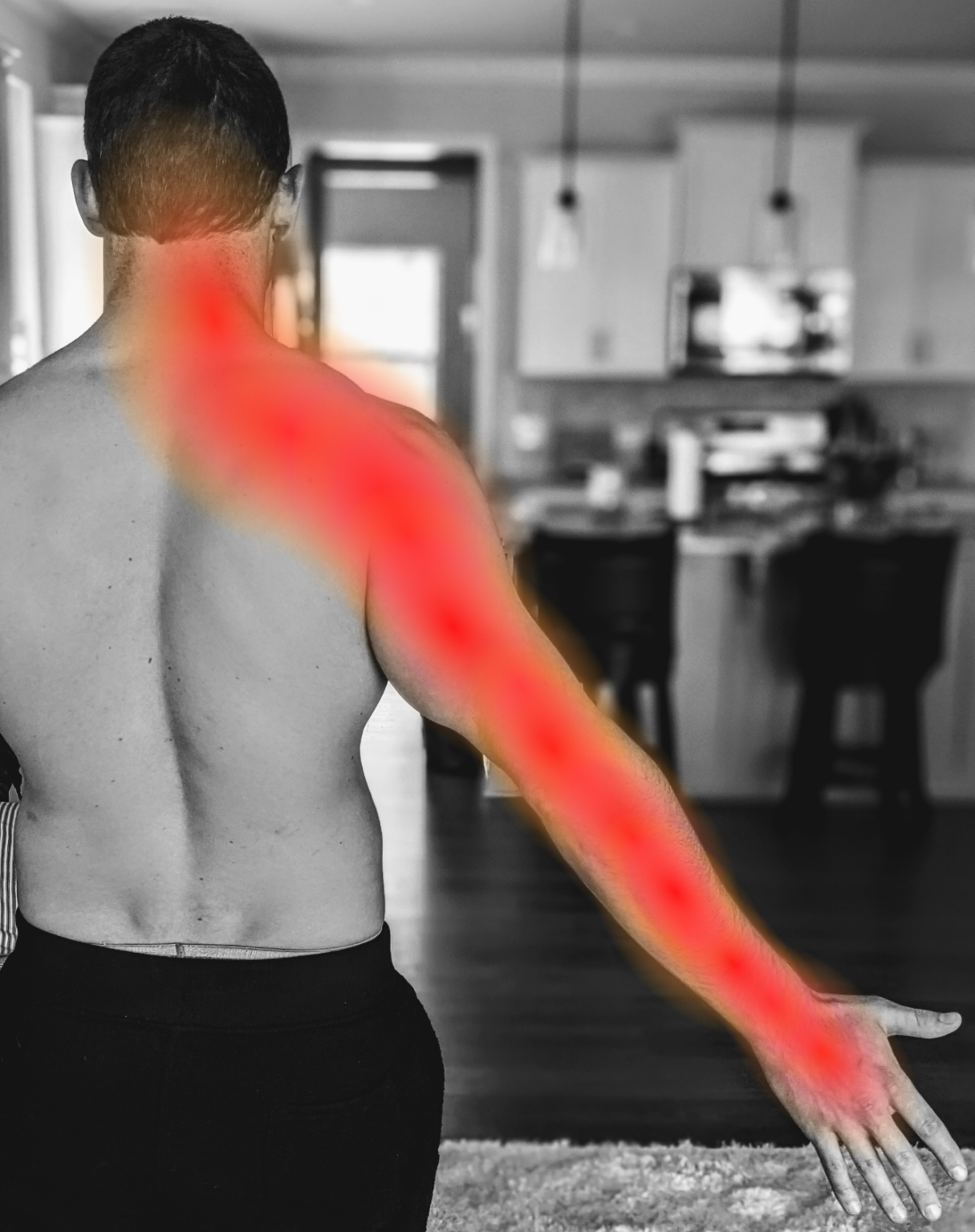 The Authoritative Guide to Cervical Radiculopathy (and 8 Effective ...