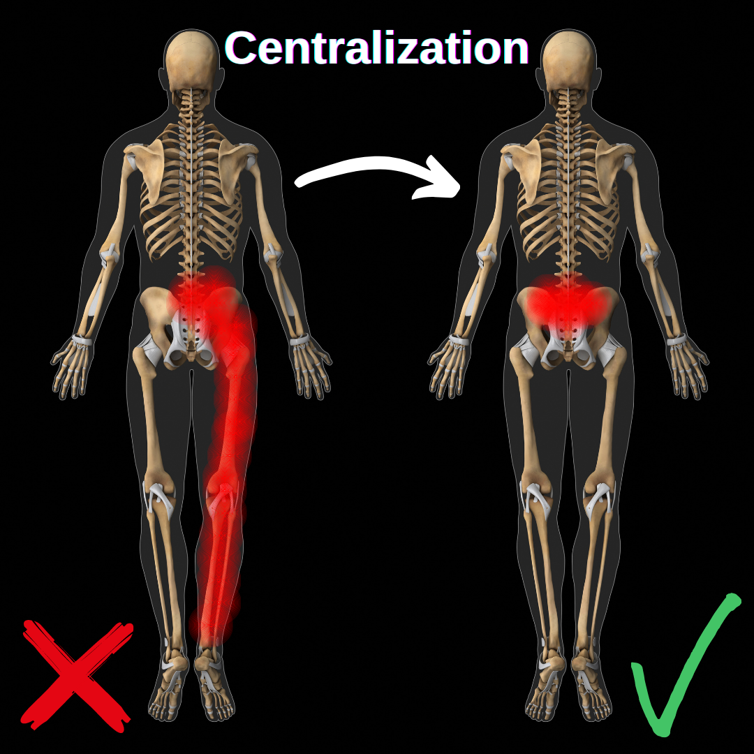 7 Proven Pinched Nerve Exercises (Lower Back Pain Relief) - Facts & Physio