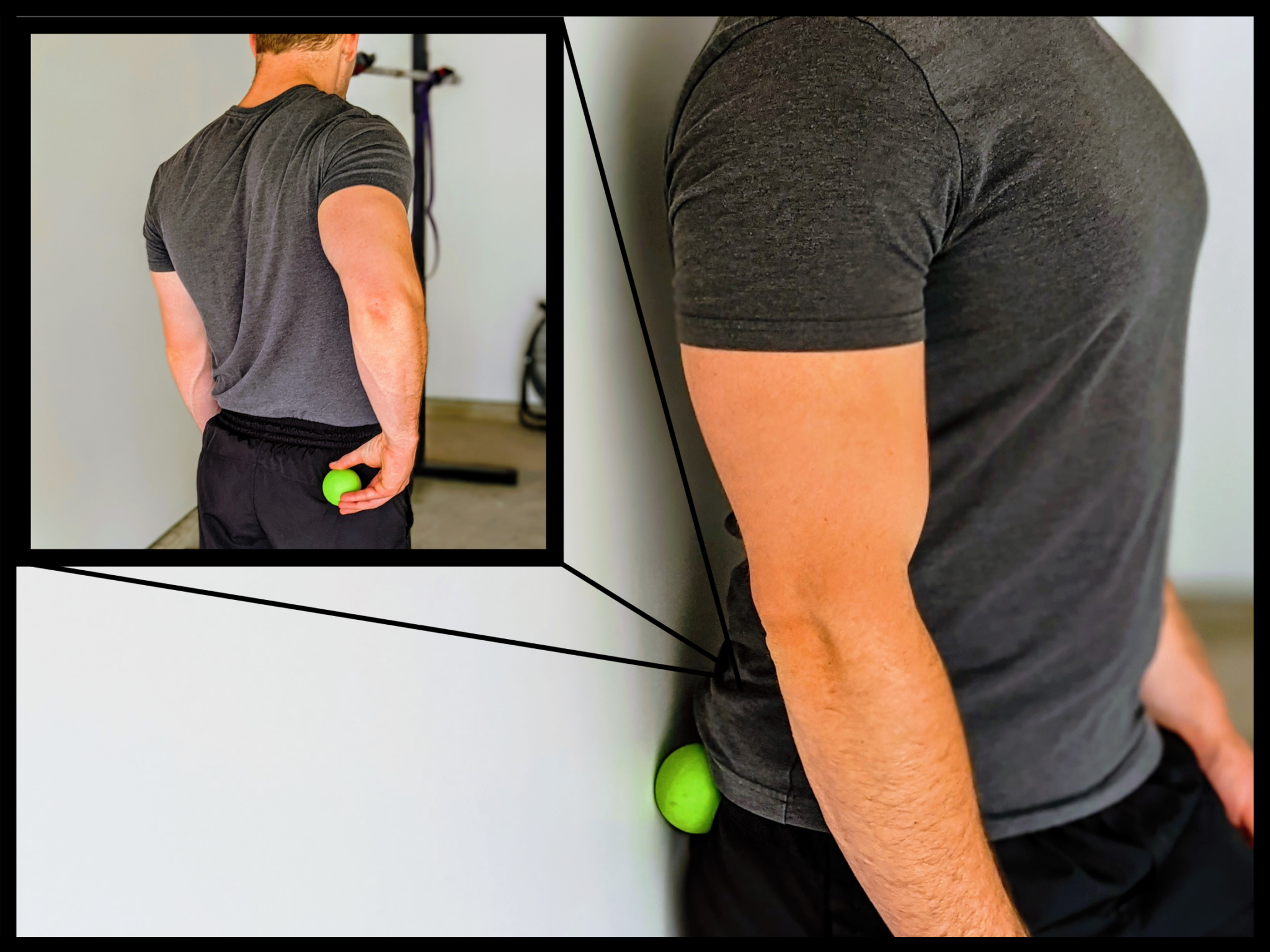 How to Fix TFL Muscle Pain (Tensor Fasciae Latae) - Facts & Physio