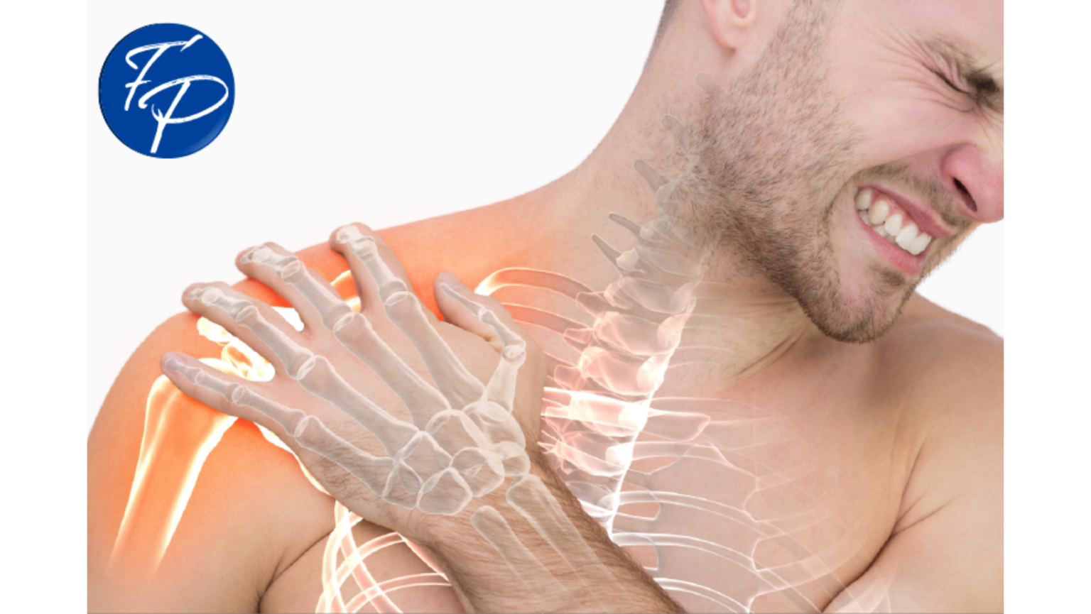 The Authoritative Guide to Dry Needling - Facts & Physio