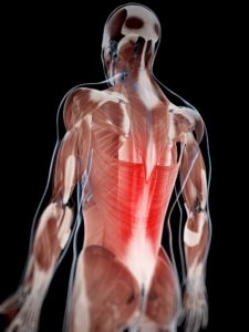 What Causes Lower Back Pain After Deadlifts? (And 5 Simple Solutions ...